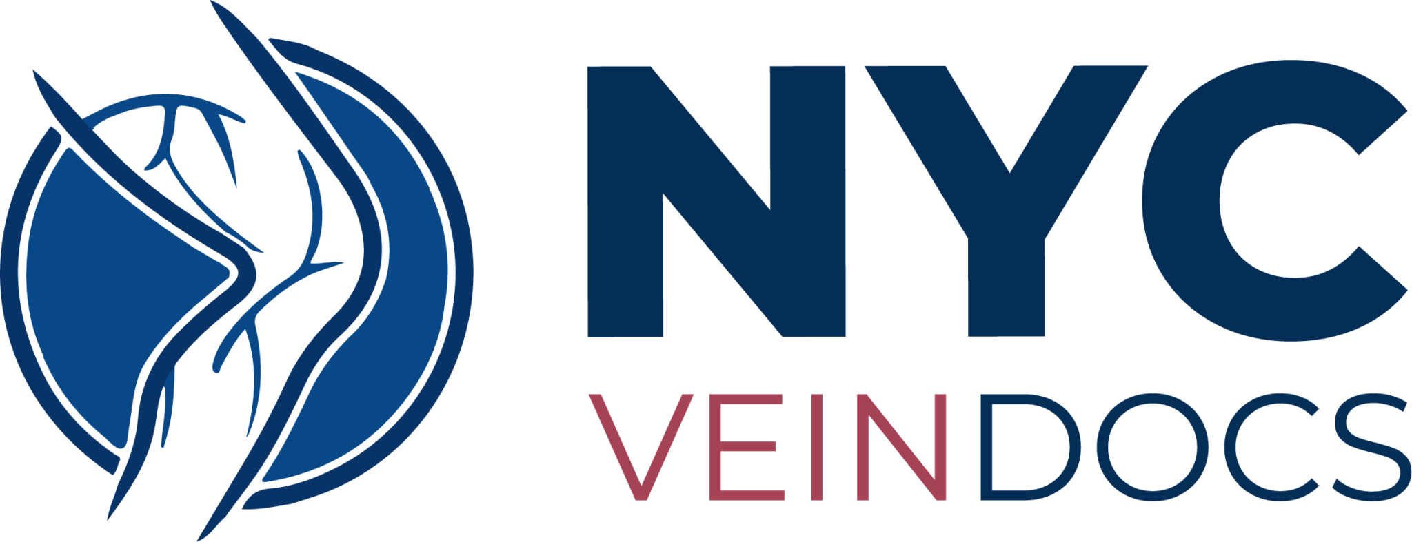 NYC Vein Docs | #1 Queens Varicose Vein Specialist